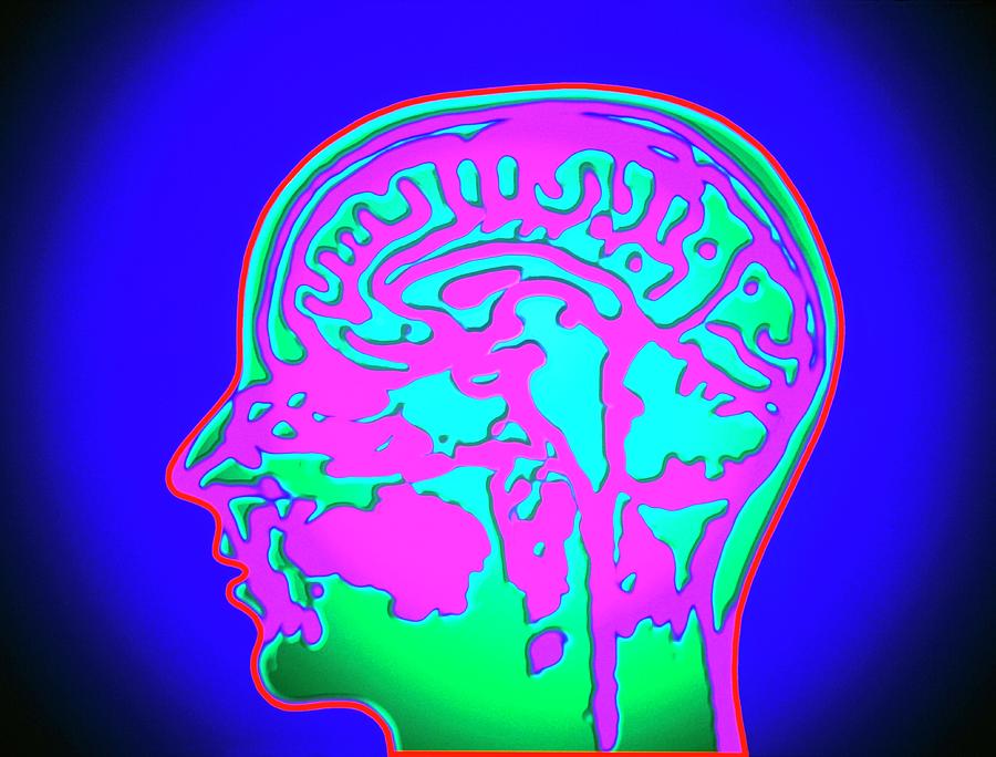Coloured Mri Scan Of The Human Head (side View) Photograph by Mehau Kulyk/science Photo Library ...