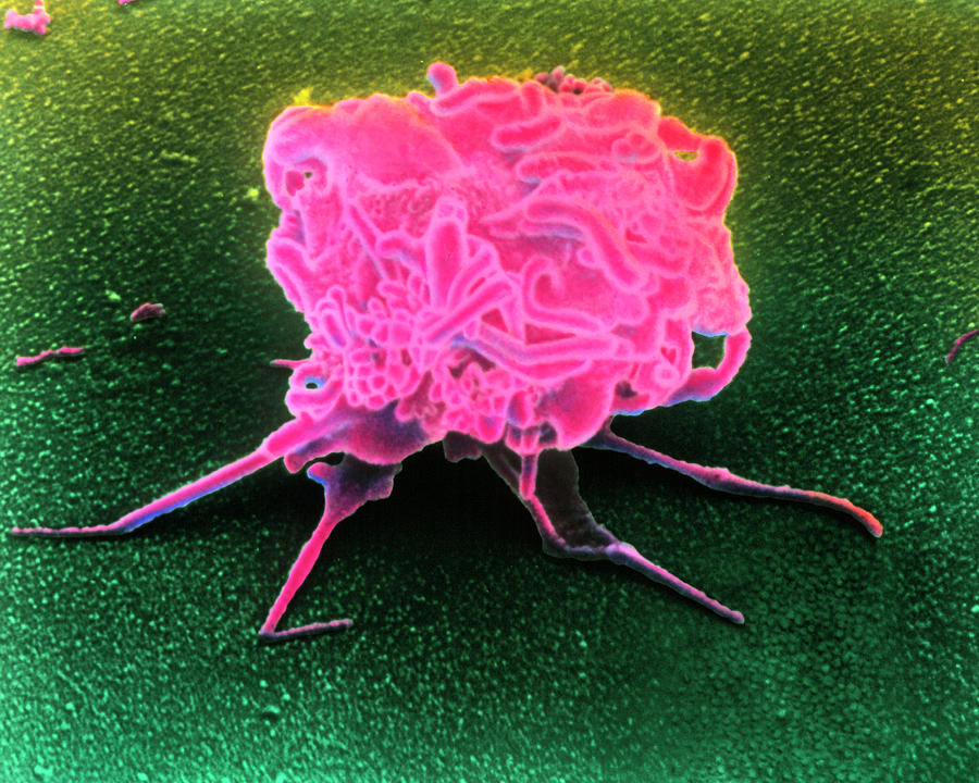 Coloured Sem Of An Activated Blood Platelet by Science Photo Library