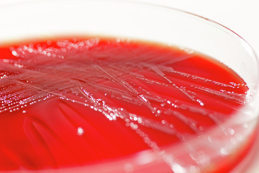 Cultured Enterococcus Faecium Bacteria Photograph by Science Photo ...