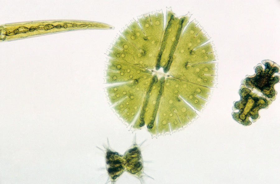 Desmids Photograph by Winton Patnode | Fine Art America