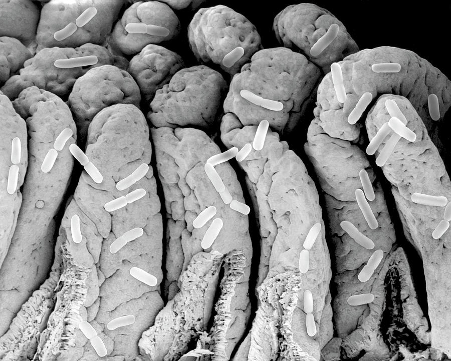 E Coli On Small Intestine Surface Photograph By Science Photo Library