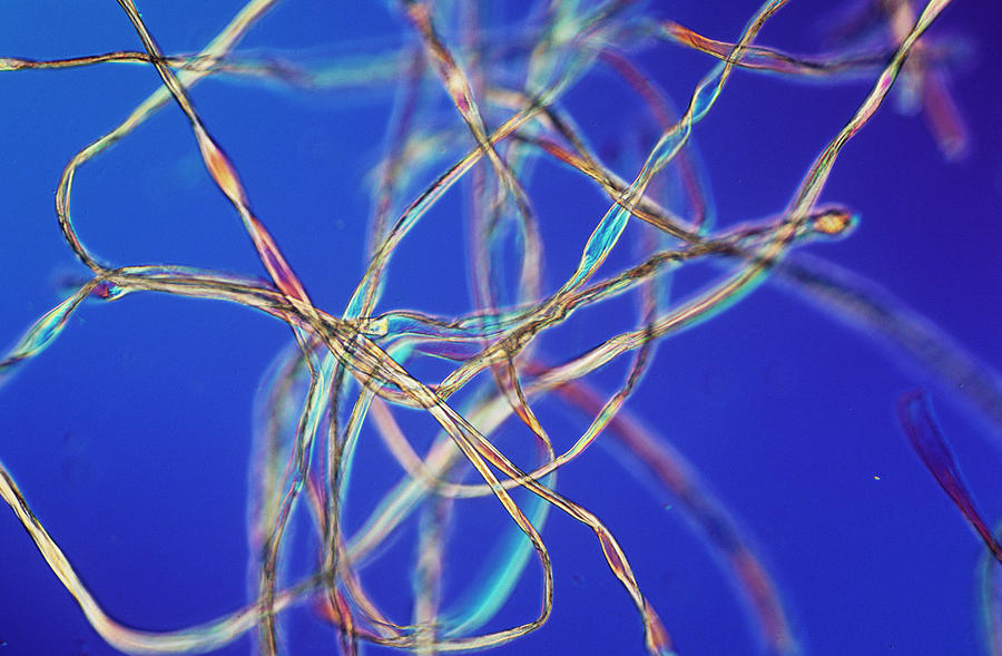 Egyptian Cotton Fibres Photograph by Astrid & Hanns-frieder Michler/science Photo Library - Fine ...