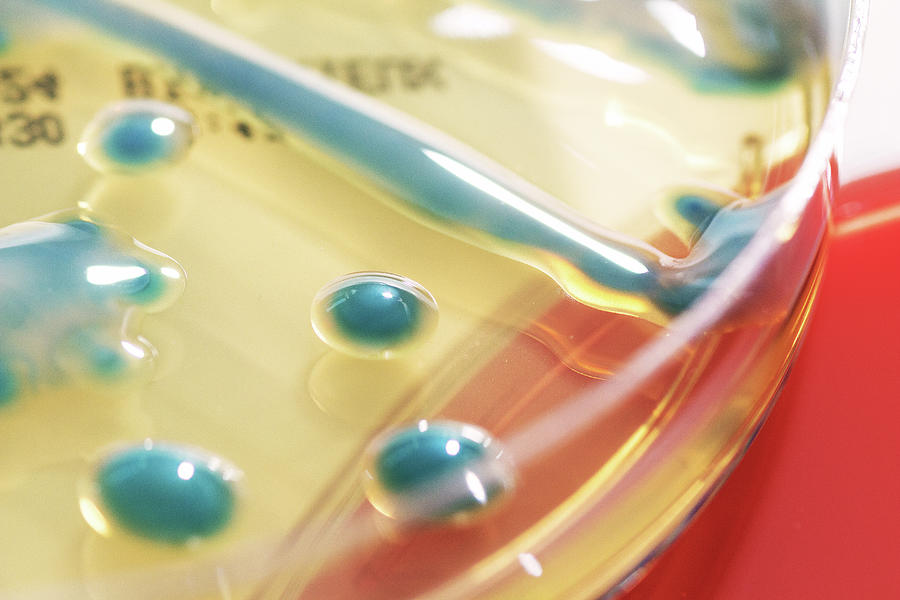 Enterobacter Bacterial Culture Photograph by Science Photo Library - Pixels