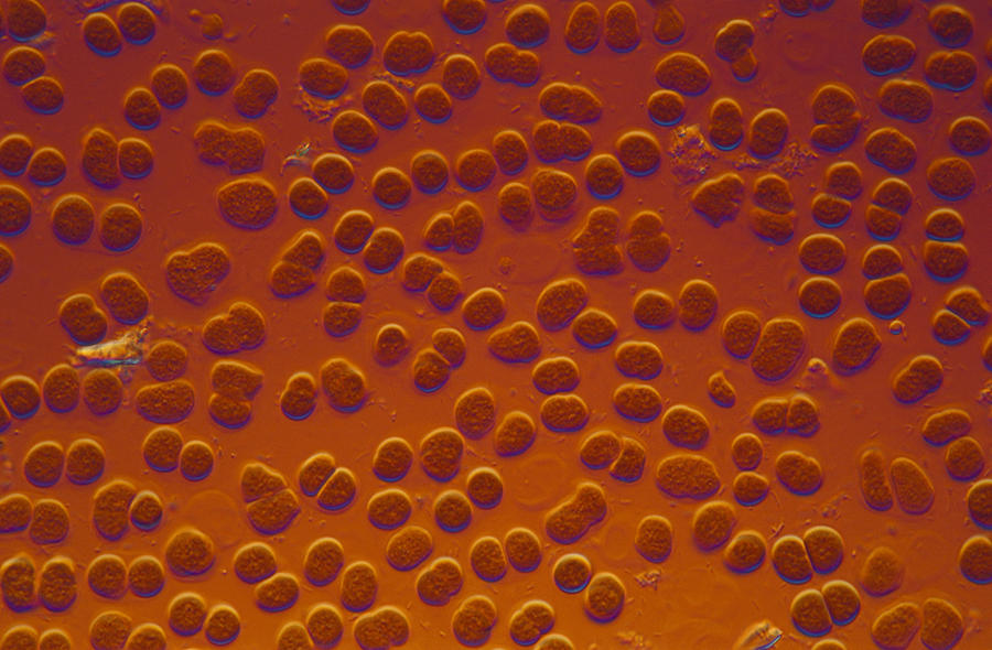 Eucapsis, Dic Photograph by Michael Abbey - Pixels