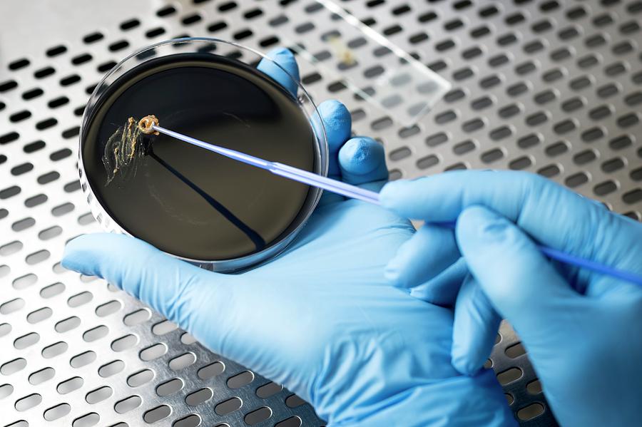 Faecal Sample Analysis by Science Photo Library