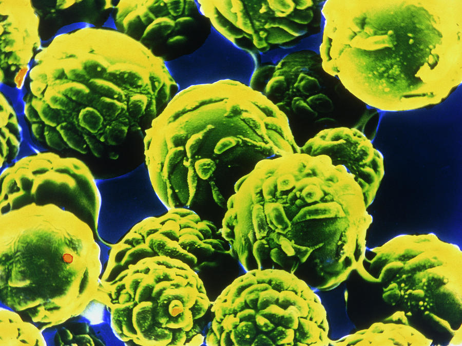 False Col Sem Of Culture Cells Photograph By Cnriscience Photo Library