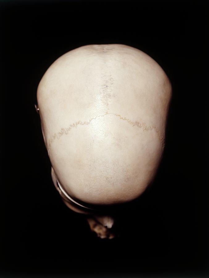 Female Human Skull Photograph by Dorling Kindersley/uig - Pixels