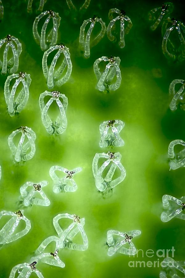 Fern Leaf Hairs, Light Micrograph by Frank Fox / Science Photo Library