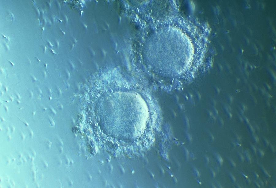 Fertilisation by Science Photo Library