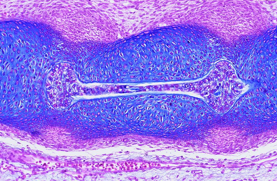 Foetal Spine by Science Photo Library