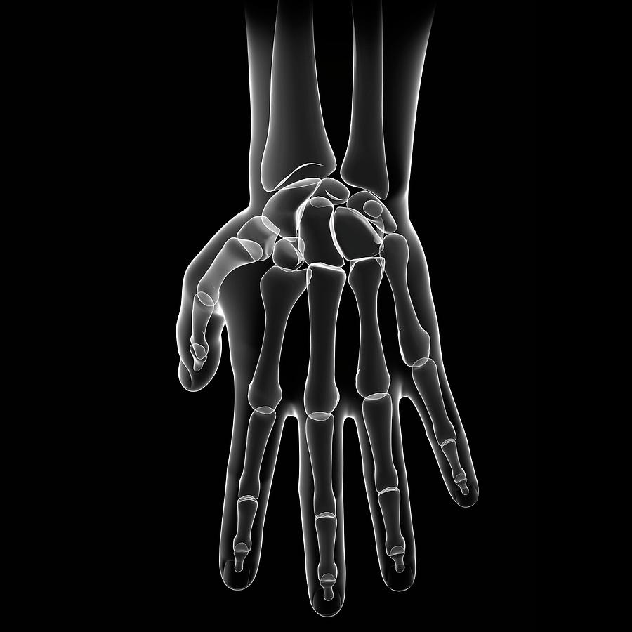 Hand Bones Photograph by Pixologicstudio/science Photo Library - Fine ...