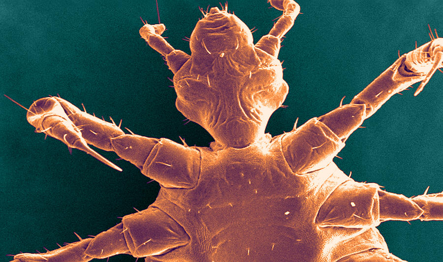 Head Louse, Sem Photograph by Science Source - Fine Art America
