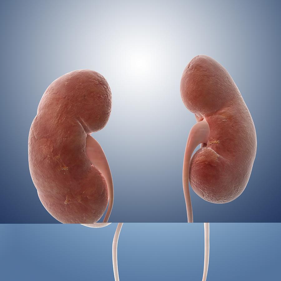Healthy kidneys, artwork Photograph by Science Photo Library - Pixels