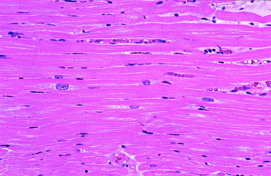 Heart Muscle by Science Photo Library
