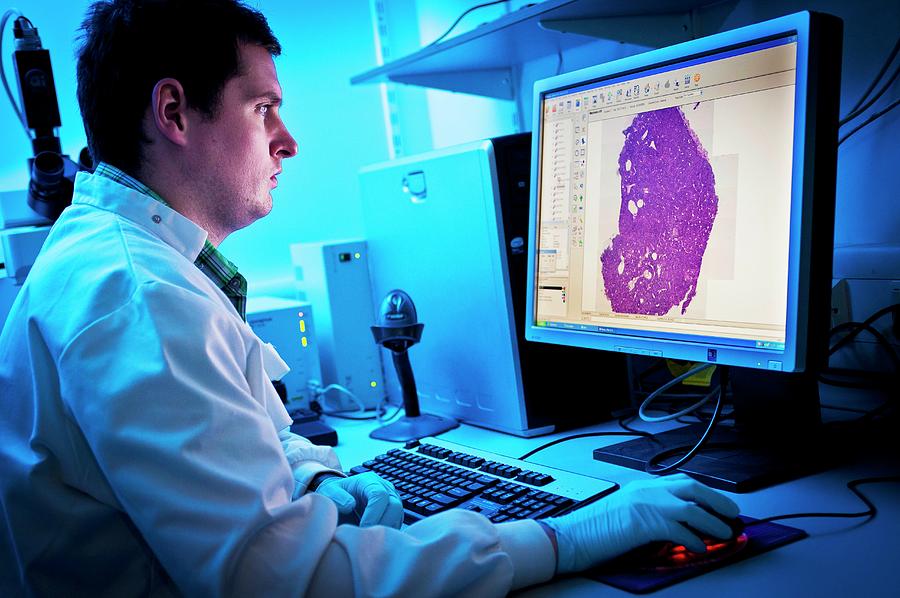 Histopathology by Science Photo Library