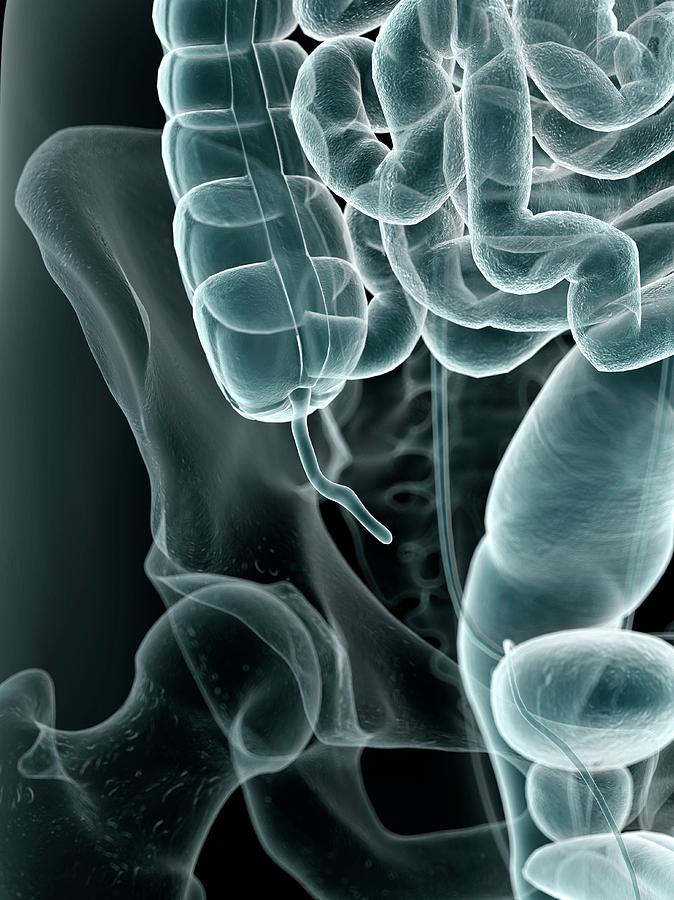 Human Appendix Photograph by Sciepro - Pixels