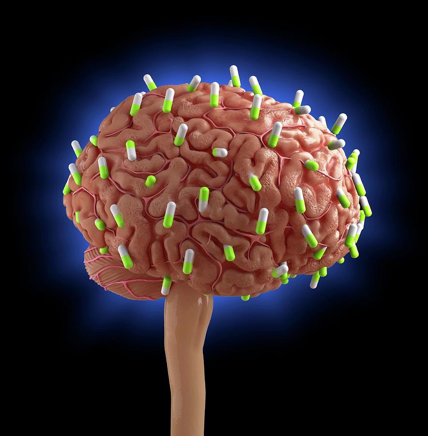 Human Brain With Capsules Photograph by Tim Vernon / Science Photo Library