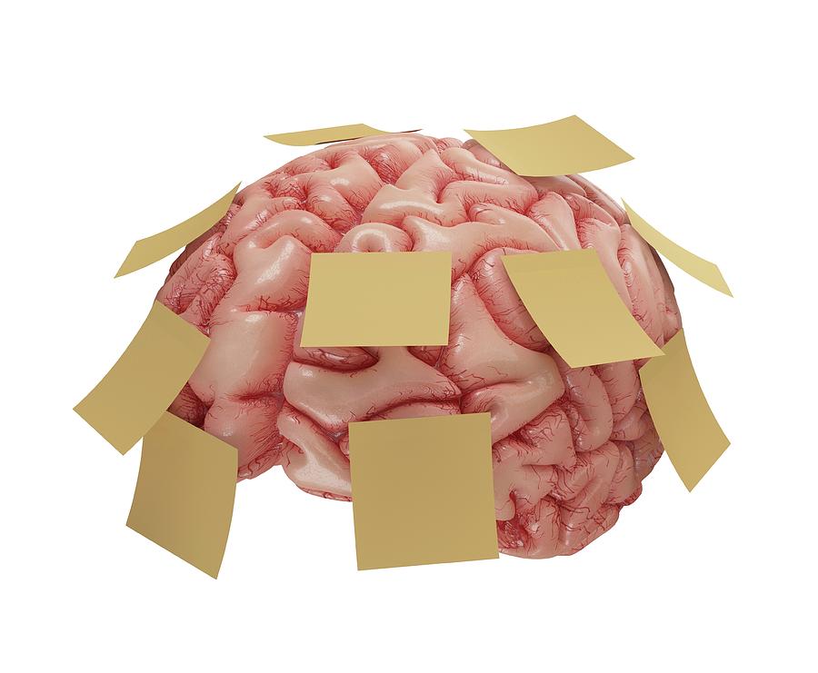Human Brain With Sticky Notes Photograph by Ktsdesign - Fine Art America
