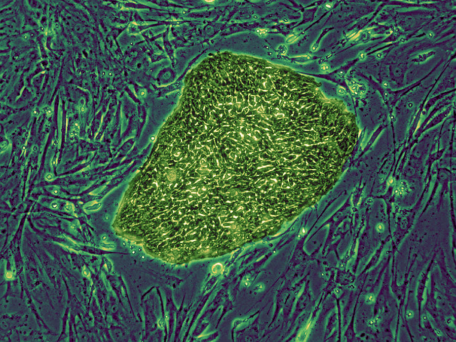 Human Embryonic Stem Cell Line Es02 Photograph by Science Source | Fine ...