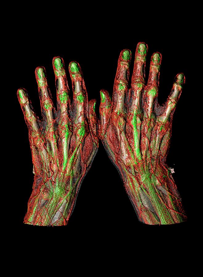 Human Hands by Science Photo Library