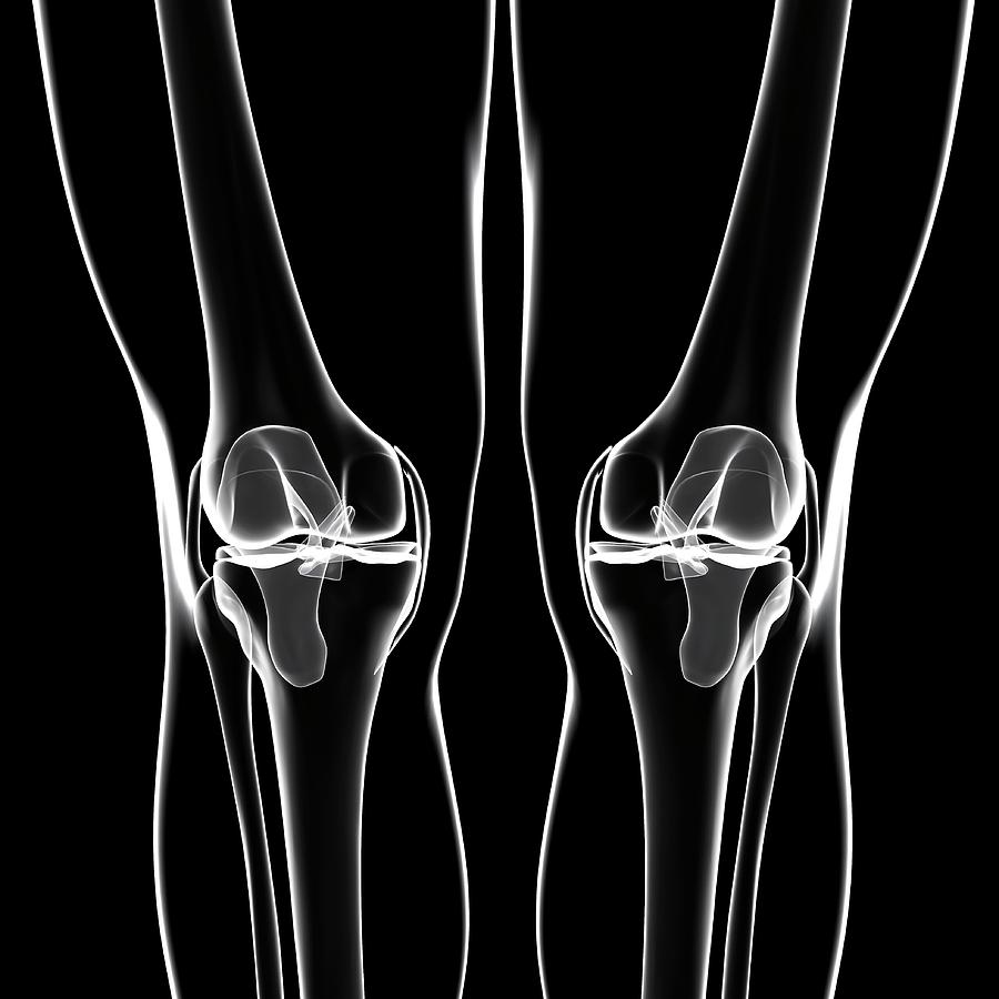 Human Knee Photograph by Pixologicstudio/science Photo Library - Pixels