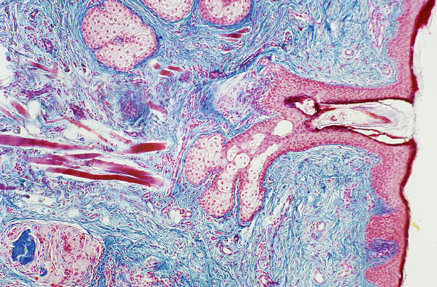 Human Skin Section Photograph by Astrid & Hanns-frieder Michler/science Photo Library - Fine Art ...