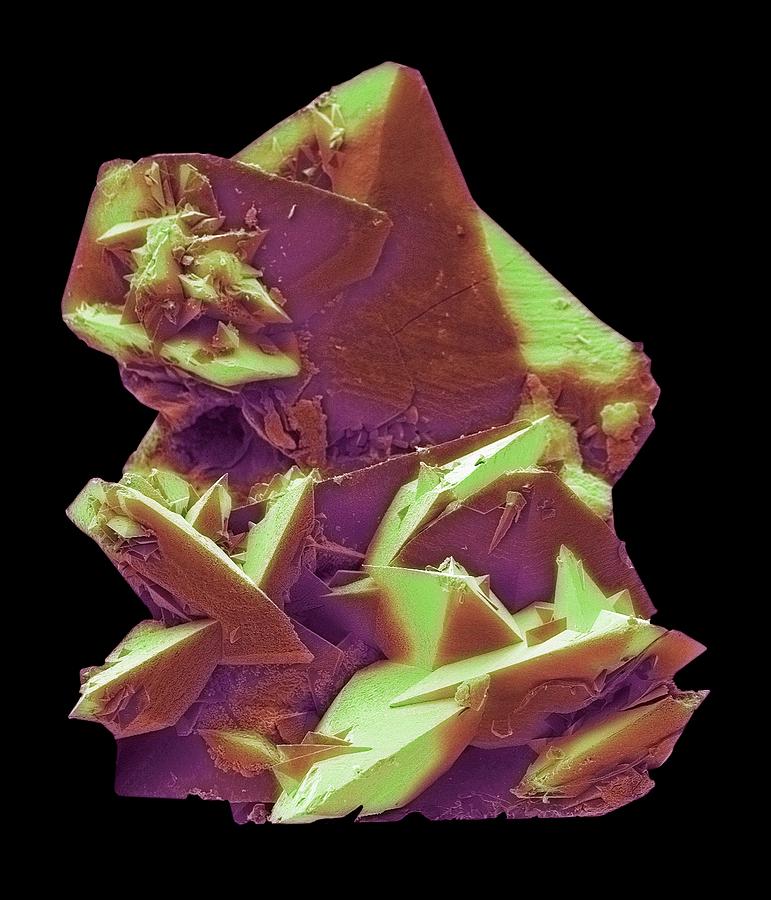 Kidney Stone by Science Photo Library