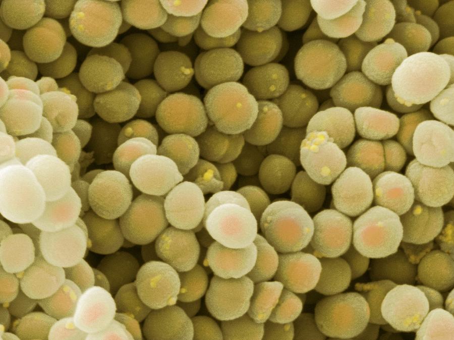 Lactococcus sp. Bacteria (SEM) Photograph by Science Photo Library ...