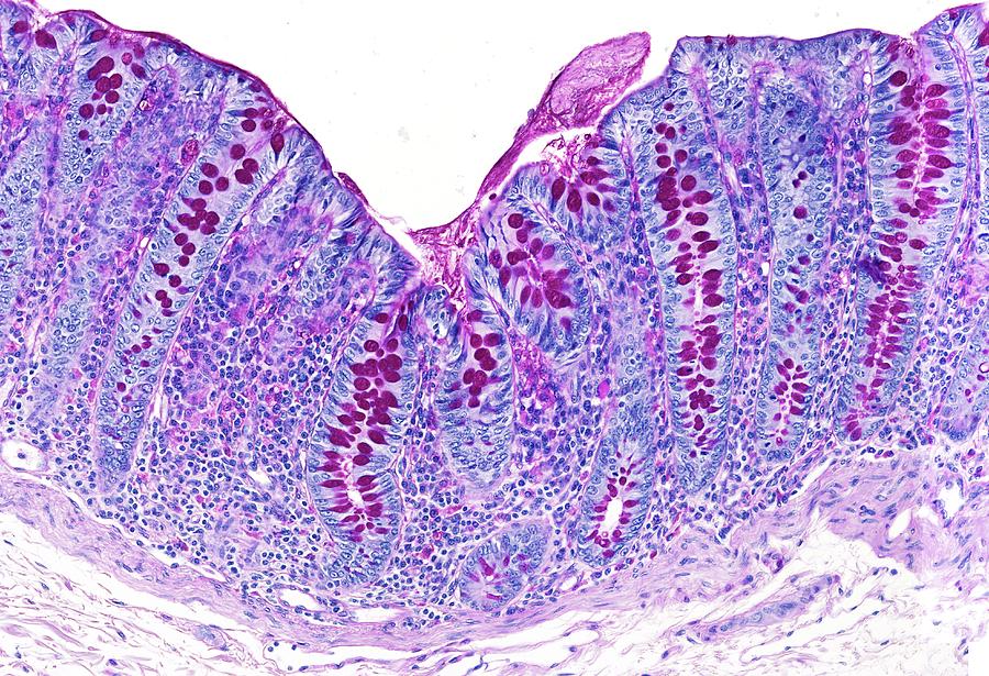 Large Intestine by Science Photo Library