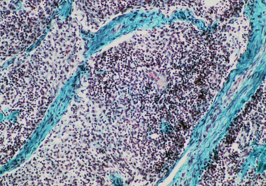 Light Micrograph Of A Normal Human Lymph Node Photograph by Astrid & Hanns-frieder Michler ...