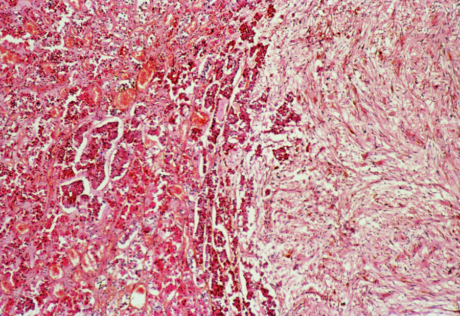 Light Micrograph Of Human Pituitary Gland Photograph By Astrid And Hanns Frieder Michlerscience
