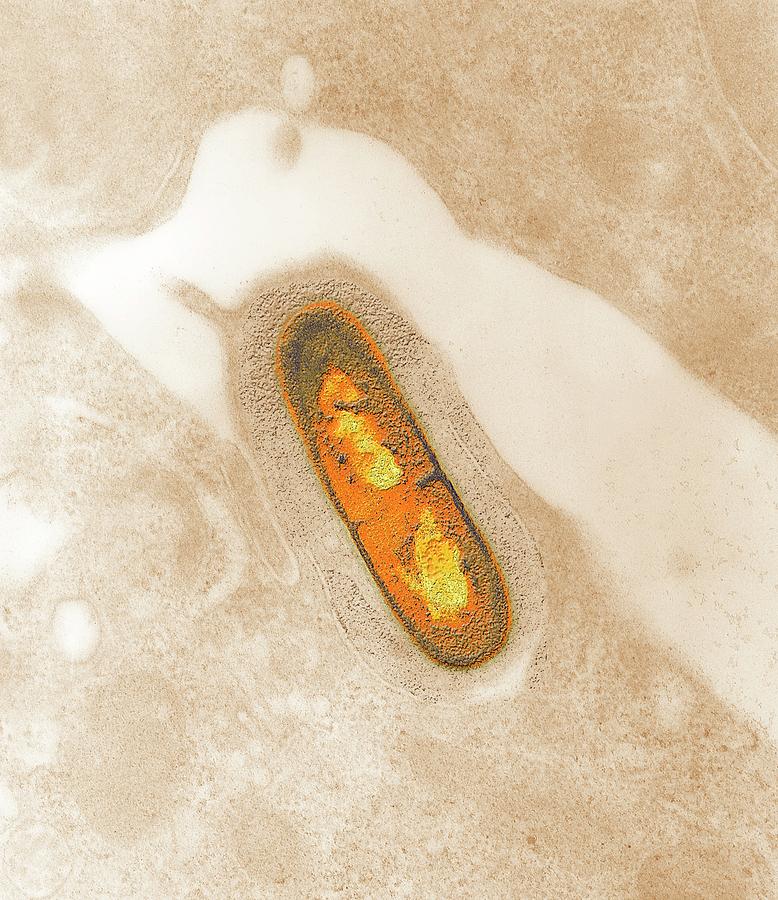 Listeria Bacteria Photograph by Ami Images/science Photo Library - Fine ...