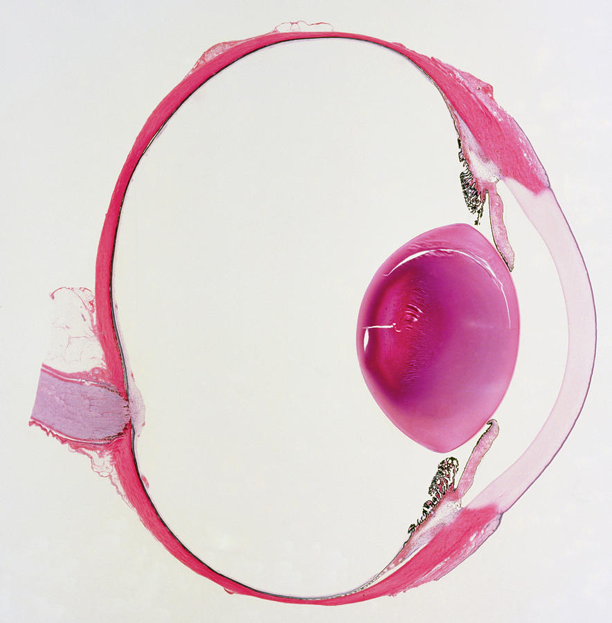 Lm Of A Longitudinal Section Of A Normal Eye Photograph by Astrid & Hanns-frieder Michler ...