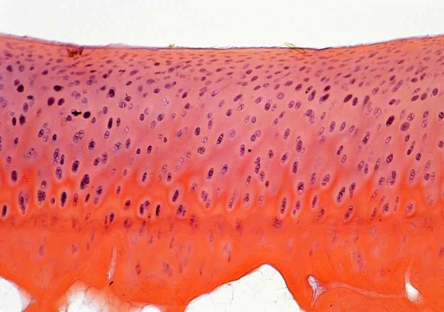 Lm Of Normal Human Cartilage Photograph by Astrid & Hanns-frieder Michler/science Photo Library ...