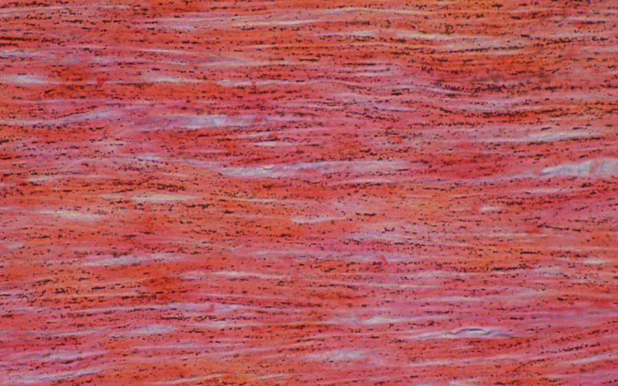 Lm Of Normal Human Sinew Photograph by Astrid & Hanns-frieder Michler/science Photo Library