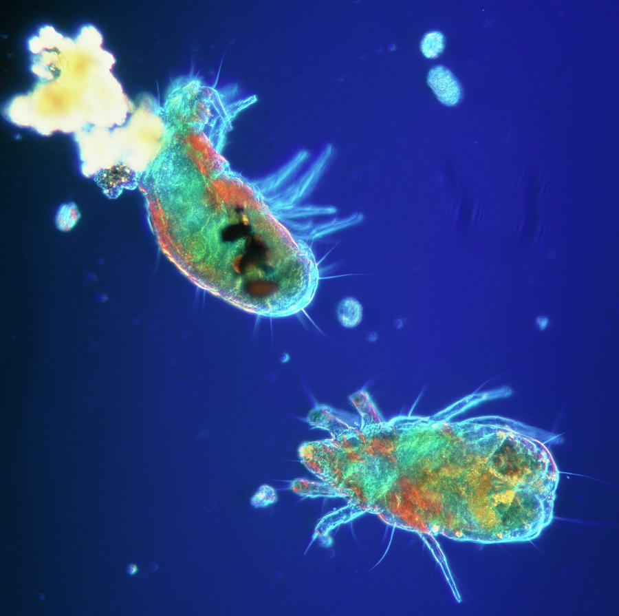 Lm Of Two Dust Mites Photograph by Alfred Pasieka/science Photo Library ...