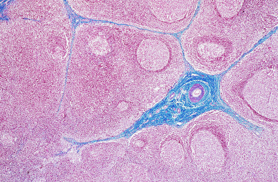 Lymph Node Photograph by Astrid & Hanns-frieder Michler/science Photo Library