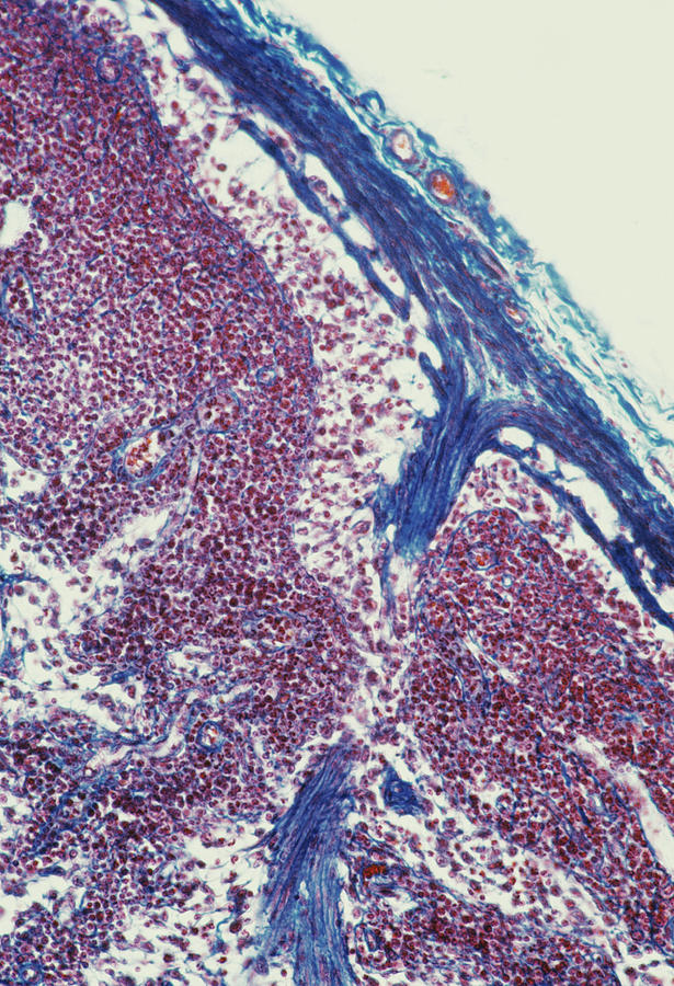 Lymph Node Photograph by Cnri/science Photo Library | Pixels