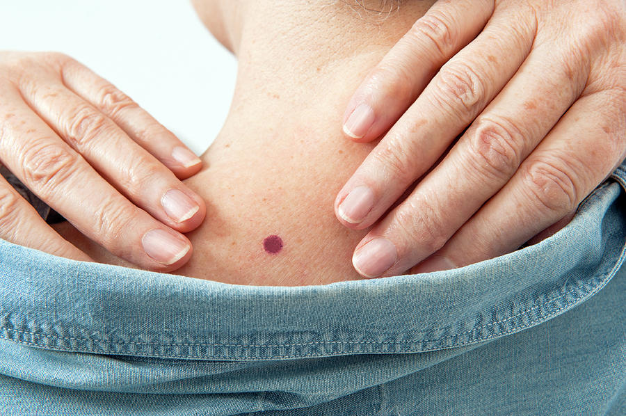 Mole Photograph by Lea Paterson/science Photo Library - Pixels