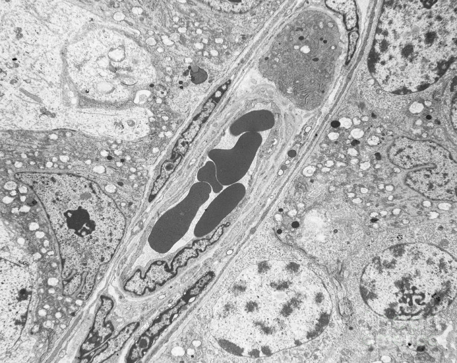 Mouse Testis, Tem Photograph by David M. Phillips - Pixels