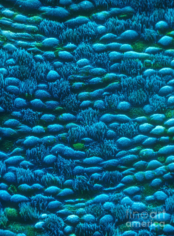 Mouse Trachea Photograph by David M. Phillips