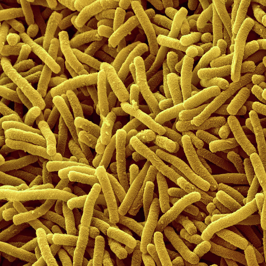 Myxococcus Xanthus Bacteria by Science Photo Library