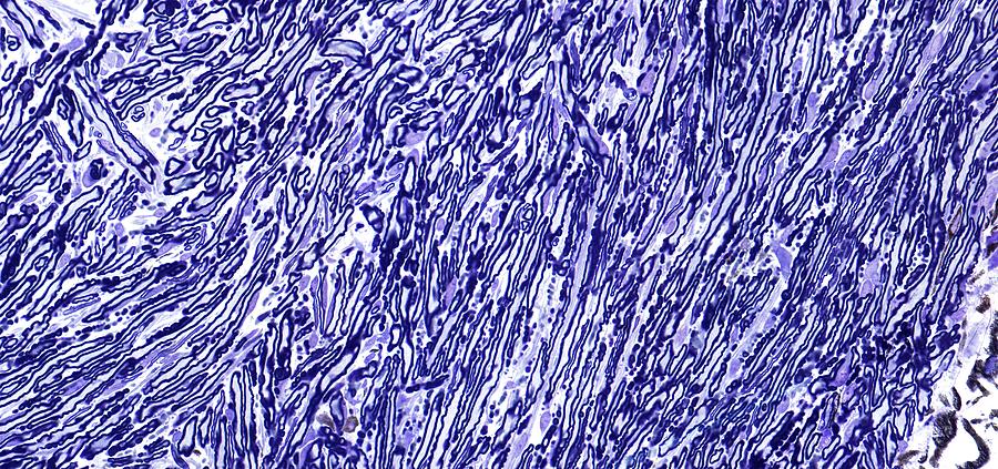 Nerve Tissue by Science Photo Library