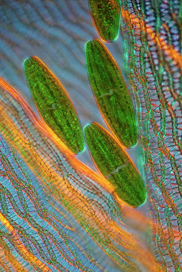 Netrium Desmids by Science Photo Library