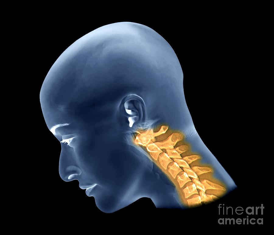 Normal Flexed Neck, X-ray by Science Photo Library
