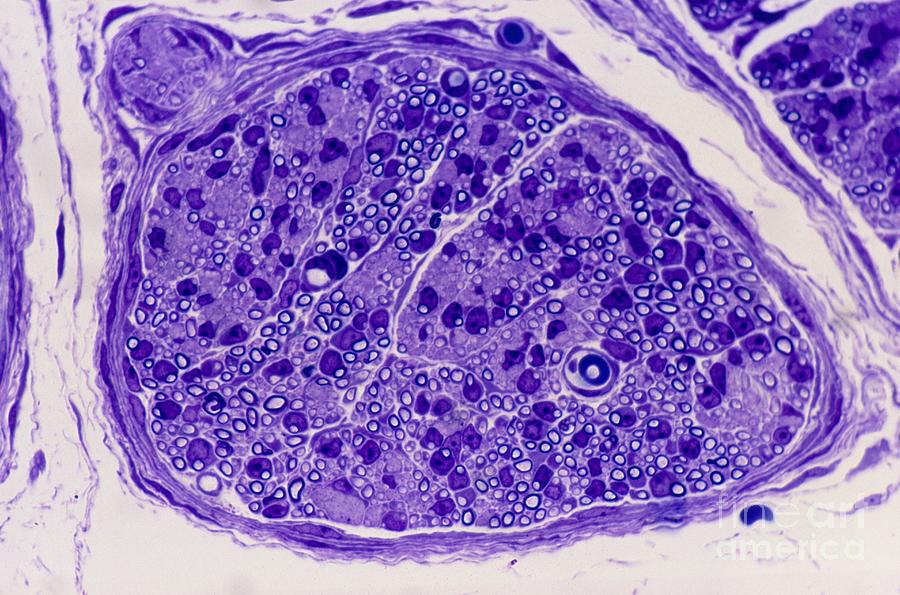 Peripheral Nerve, Light Micrograph by Science Photo Library
