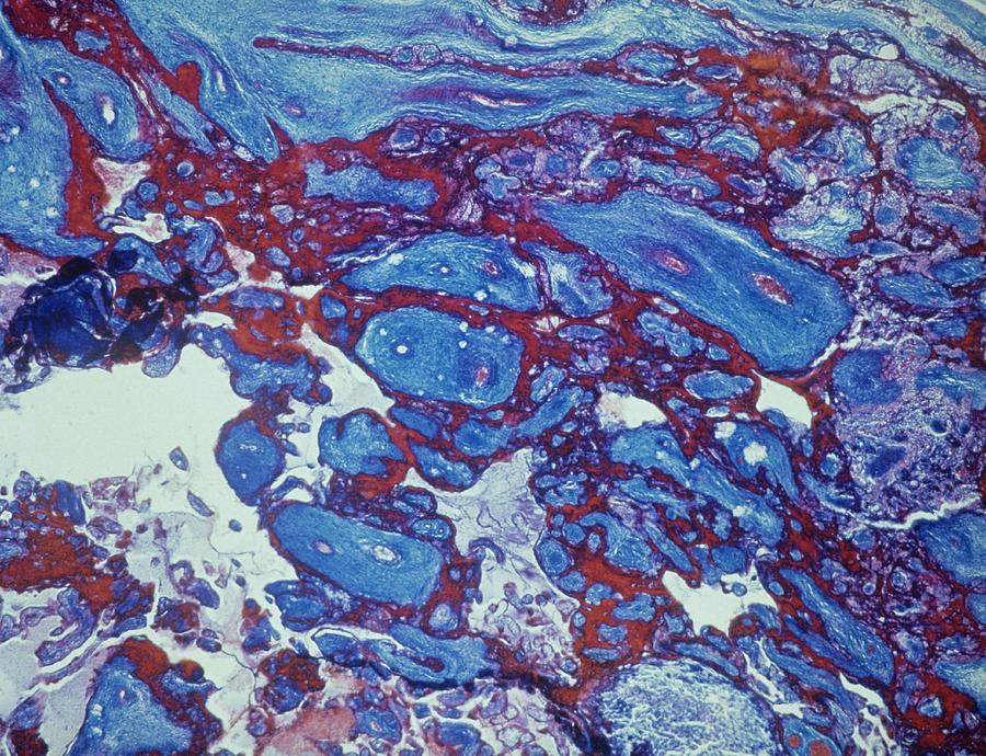 Placenta, light micrograph Photograph by Science Photo Library - Fine ...
