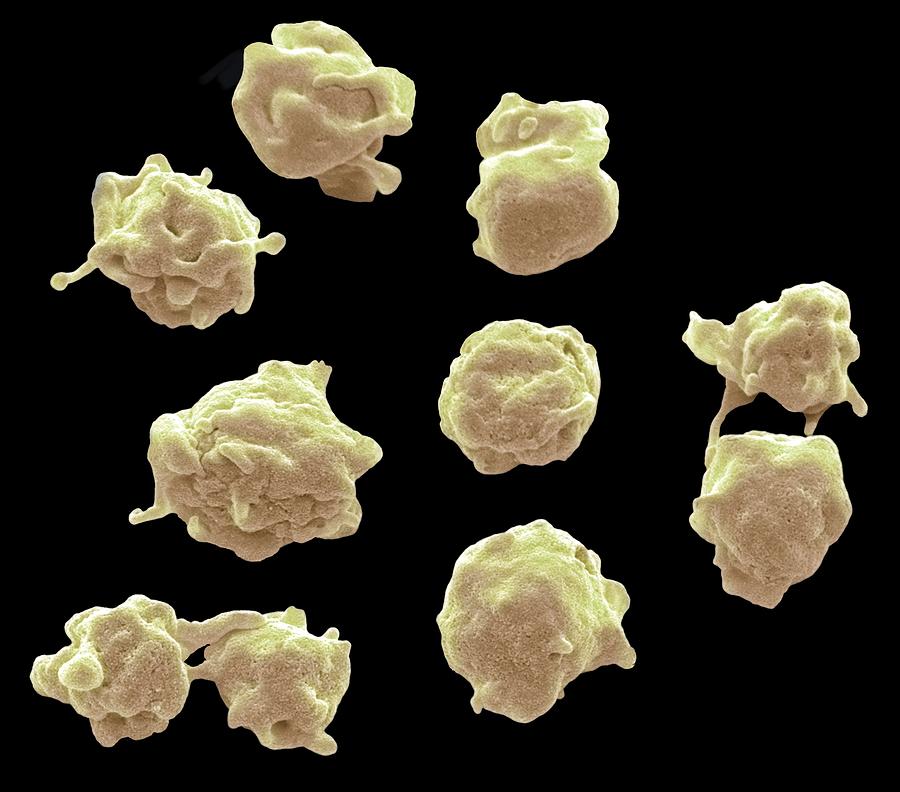 Platelets, Sem Photograph by Science Photo Library