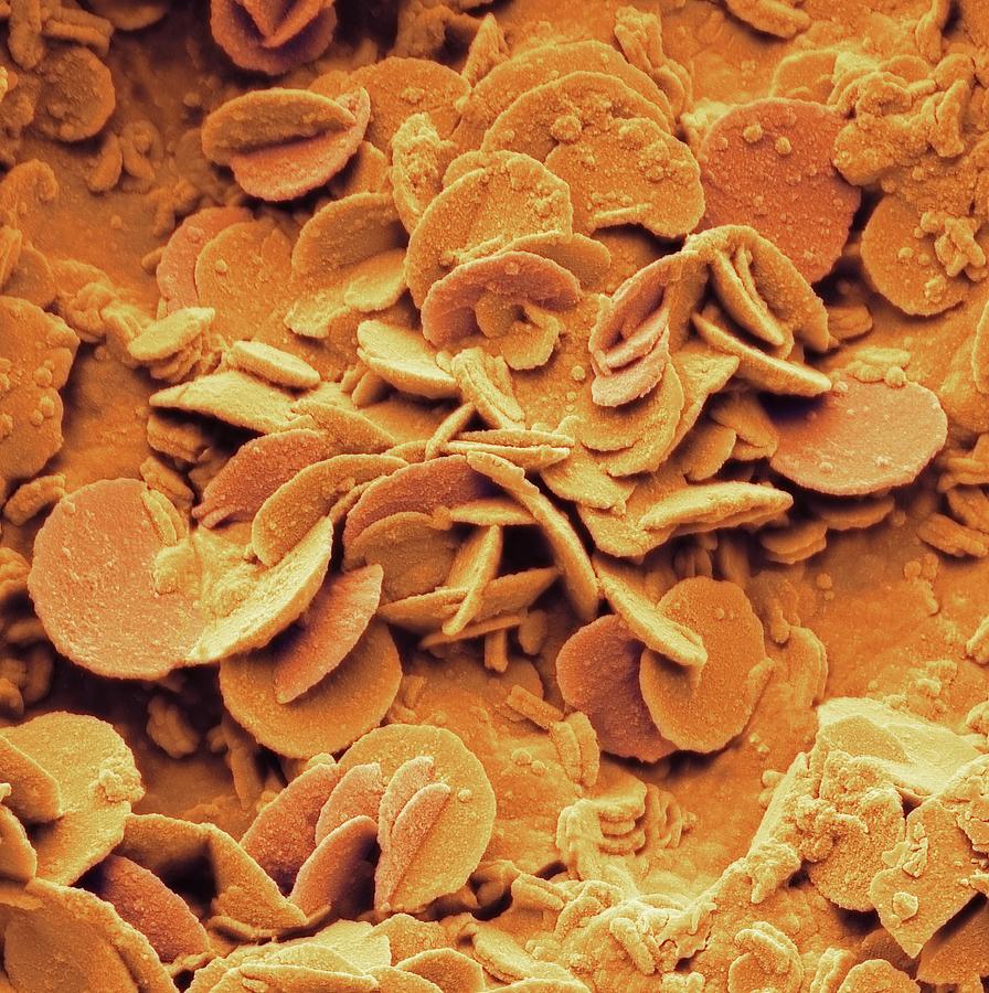 Rust Photograph by Steve Gschmeissner/science Photo Library - Pixels