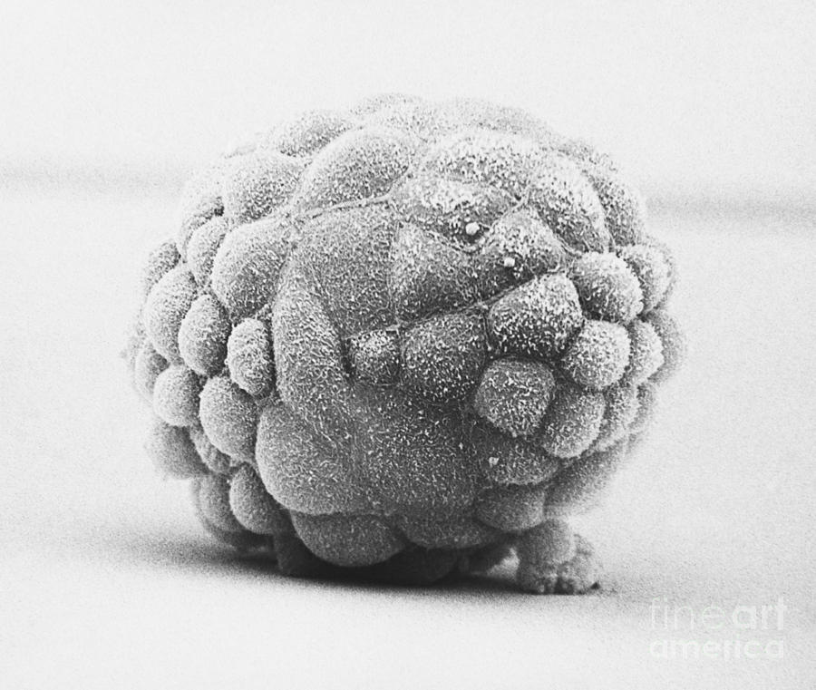 Sem Of Horse Embryo Photograph by David M. Phillips | Pixels